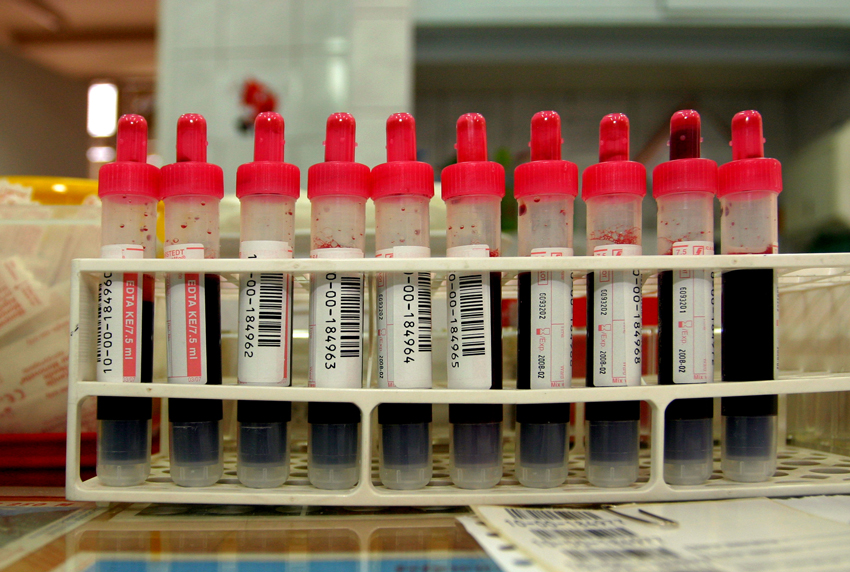 Specimen Tracking System | Sample Tracking System