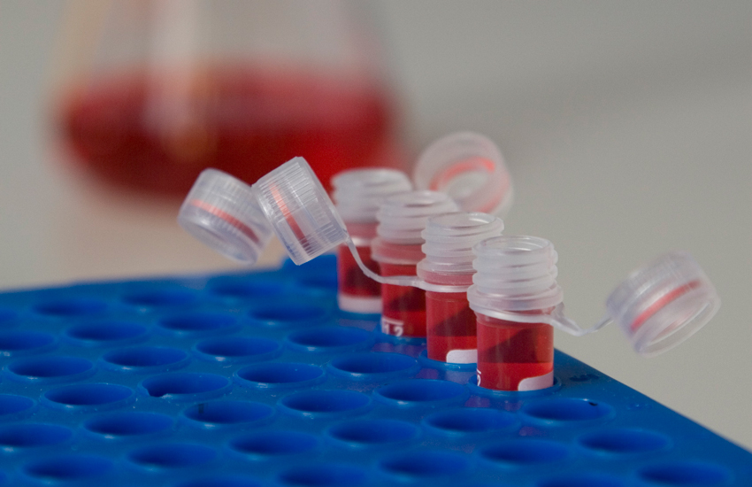 Specimen Tracking System | Sample Tracking System